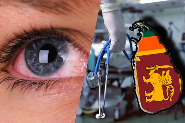 கண் சிவக்கும் தன்மை அதிகரித்தால் அது ஆபத்தான நிலை: மக்களுக்கு கடும் ...