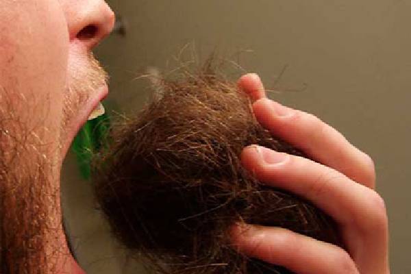 உணவிற்கு பதிலாக தலைமுடியை சாப்பிடும் அரிய வகை நோய்! அதிர்ச்சி கொடுத்த ...