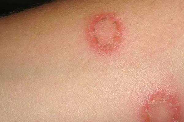 நாட்டில் மிக வேகமாக பரவும் புதிய நோய்! - ஜே.வி.பி நியூஸ்