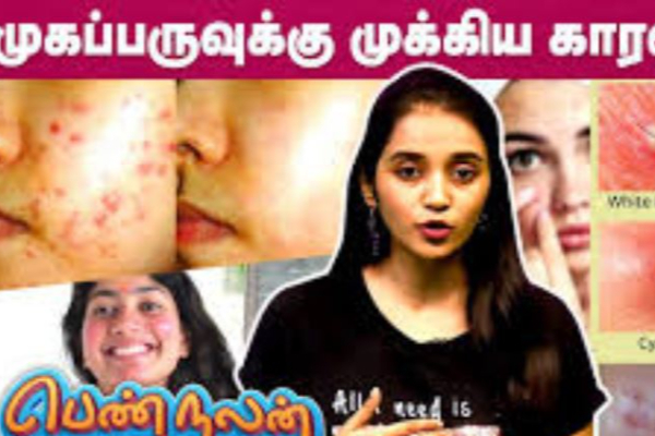 ஒரே இரவில் Pimples போக்க வேண்டுமா? அப்ப இந்த வழிகளை ட்ரை பண்ணுங்க ...