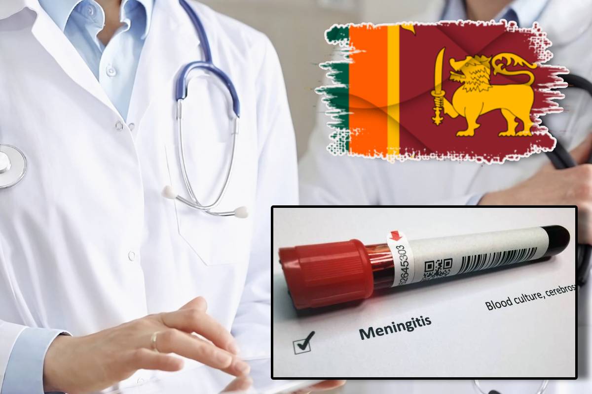 இலங்கையில் மெனிஞ்சைடிஸ் வைரஸ் தொற்றுடன் 237 பேர் அடையாளம் - ஐபிசி தமிழ்